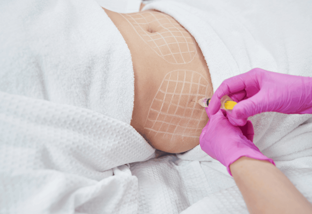Fat Dissolving Injections - Target Stubborn Fat Safely